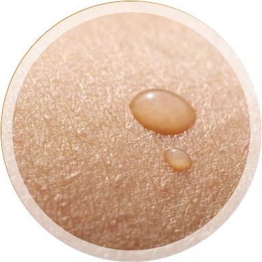 skin - www.Strataderm.com